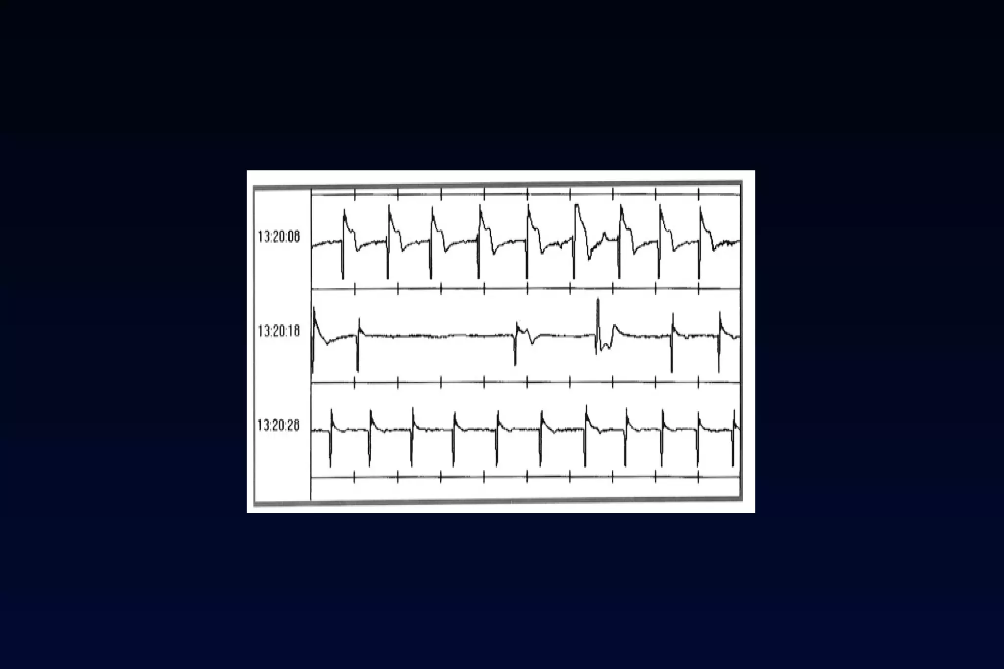 Fainting: Causes and Ways to Minimize Risk | PPT