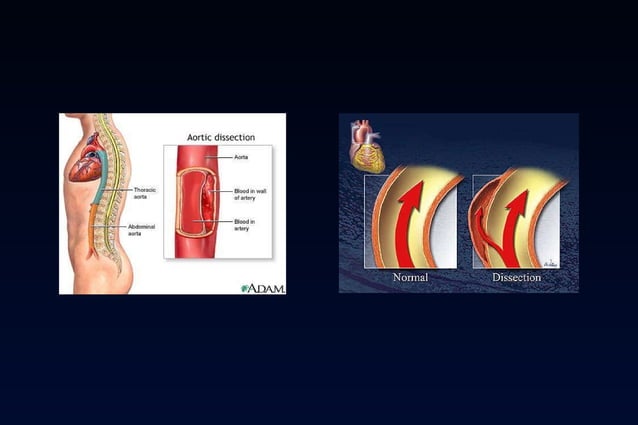 Fainting: Causes and Ways to Minimize Risk | PPT