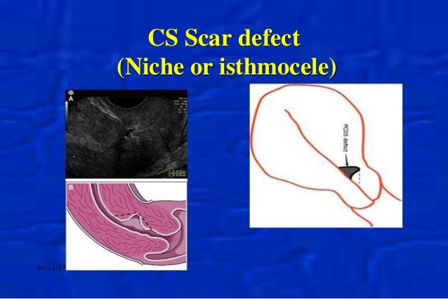 Fairmonte 2014 treatment of niche asogic
