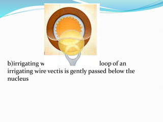 faizal s ppt op.pptx