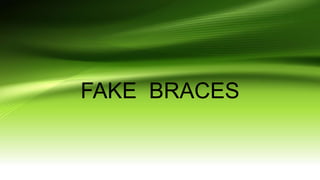 Fake braces | PPTX