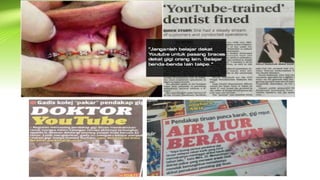 Fake braces | PPTX