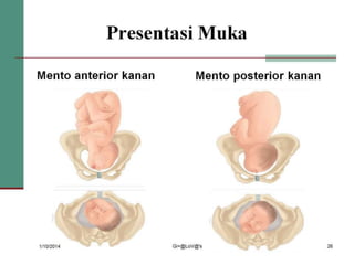 Faktor faktor yang mempengaruhi persalinan -power-passenger- | PPTX