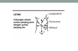 FAKTOR-FAKTOR YANG MEMPENGARUHI PERSALINAN (2).pptx