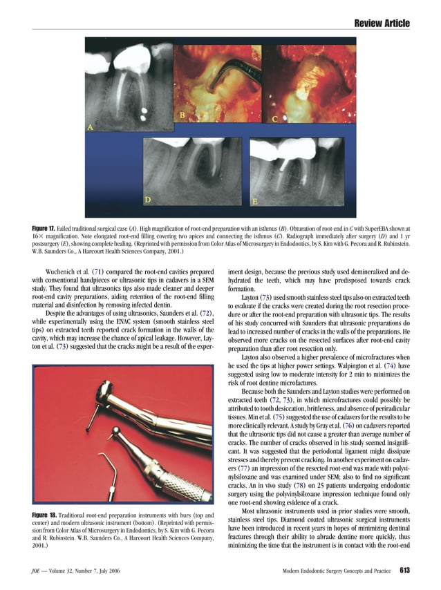 Modern Endodontic surgery - modern techniques | PDF