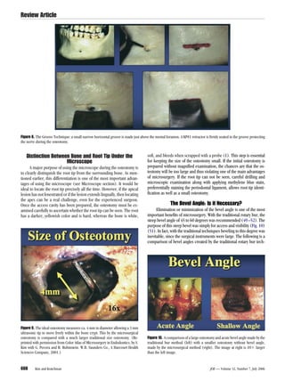 Modern Endodontic surgery - modern techniques | PDF