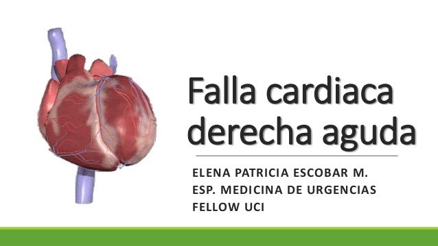 Falla cardiaca derecha