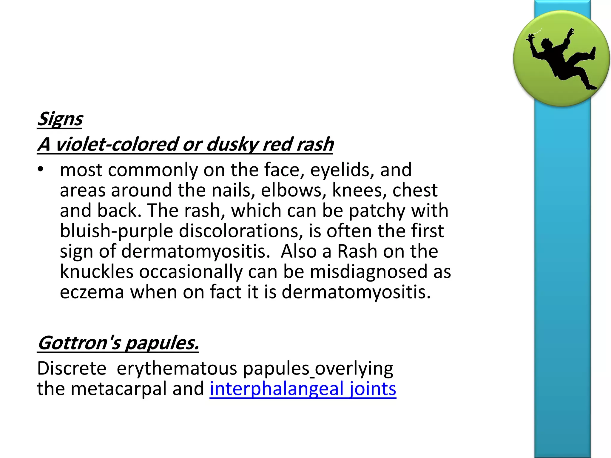 Neurological Causes of Frequent Falling | PPT