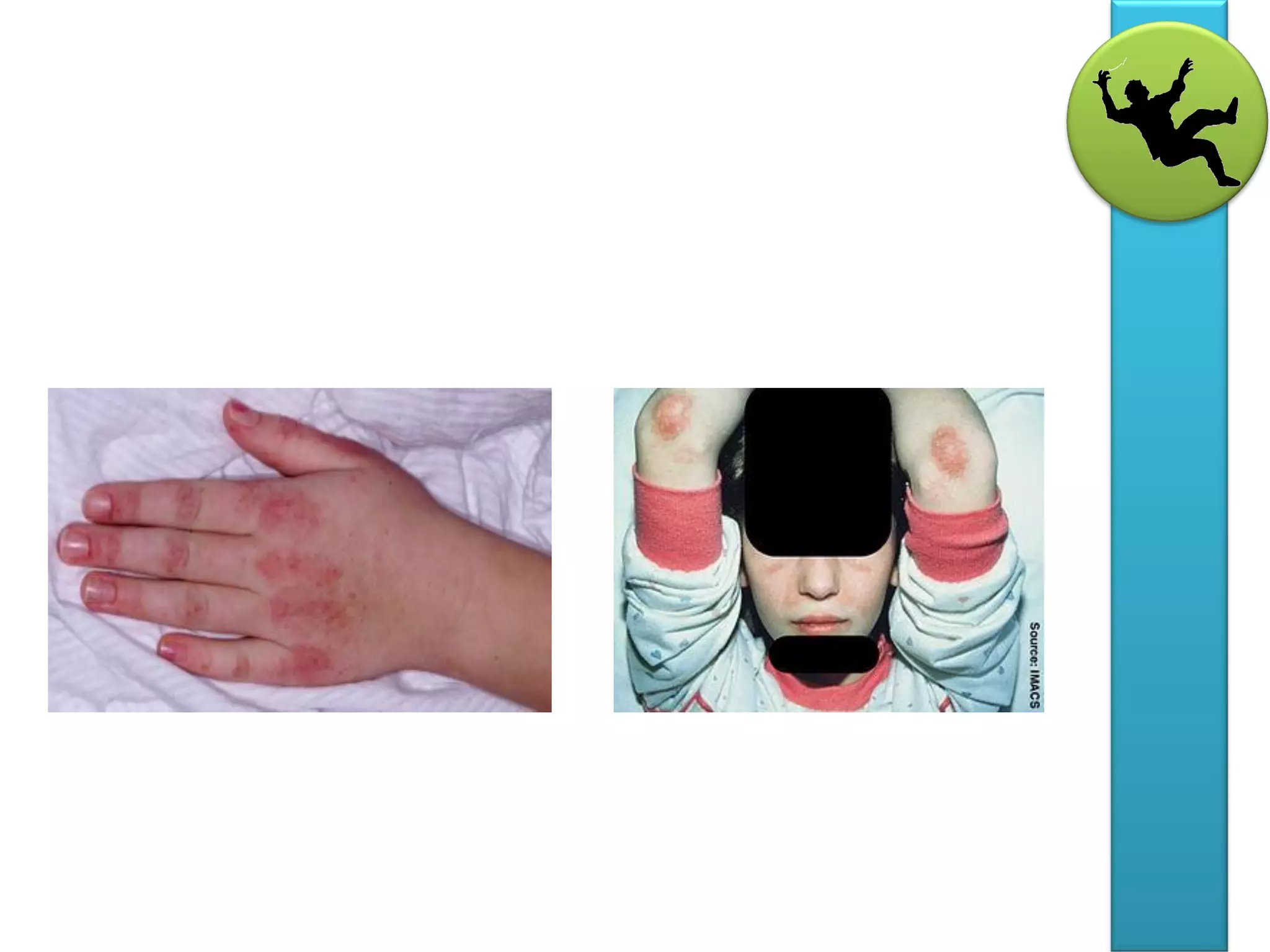 Neurological Causes of Frequent Falling | PPT