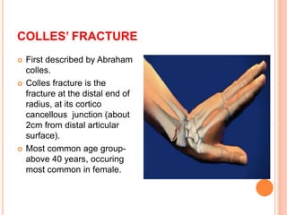 Fall on an outstrtched hand | PPT