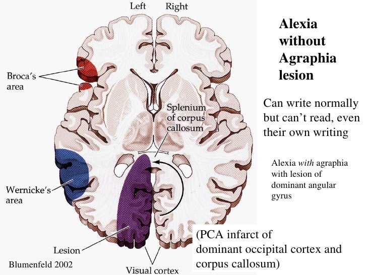 Fallon Higher Cereb Funct I Ii Iii 2007