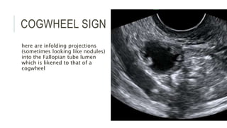 Fallopian tube Imaging Radiology | PPTX