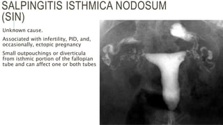Fallopian tube Imaging Radiology | PPTX