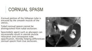 Fallopian tube Imaging Radiology | PPTX