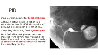 Fallopian tube Imaging Radiology | PPTX
