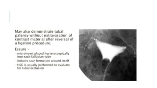 Fallopian tube Imaging Radiology | PPTX