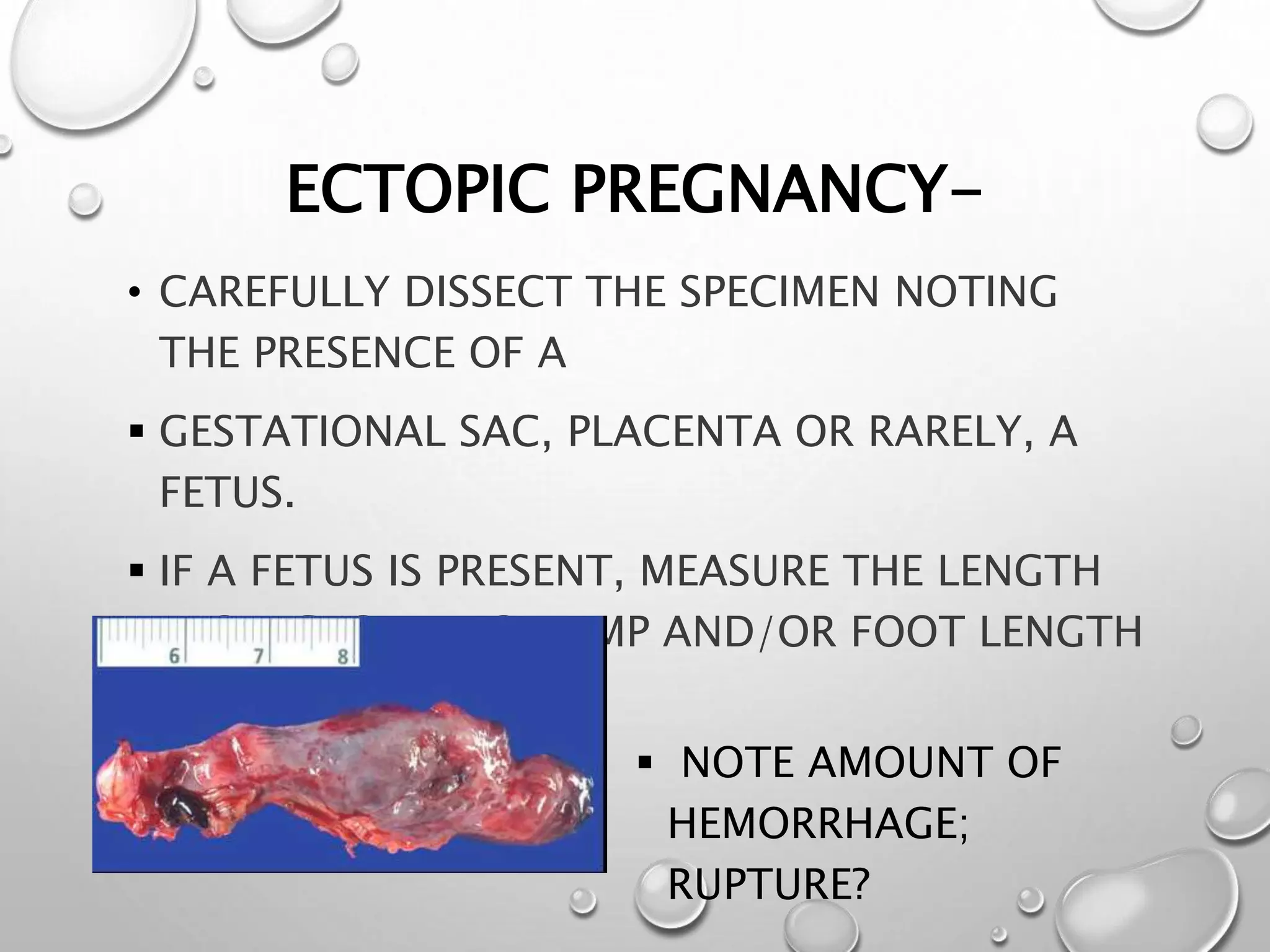fallopian tube and ovary.pptx