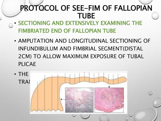 fallopian tube and ovary.pptx