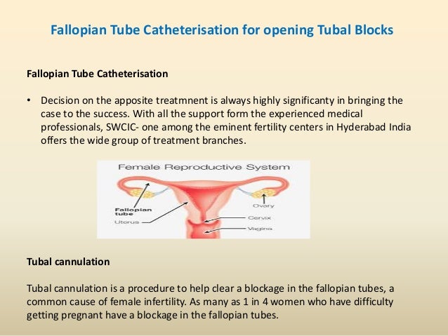 Fallopian Tube Catheterisation Treatment