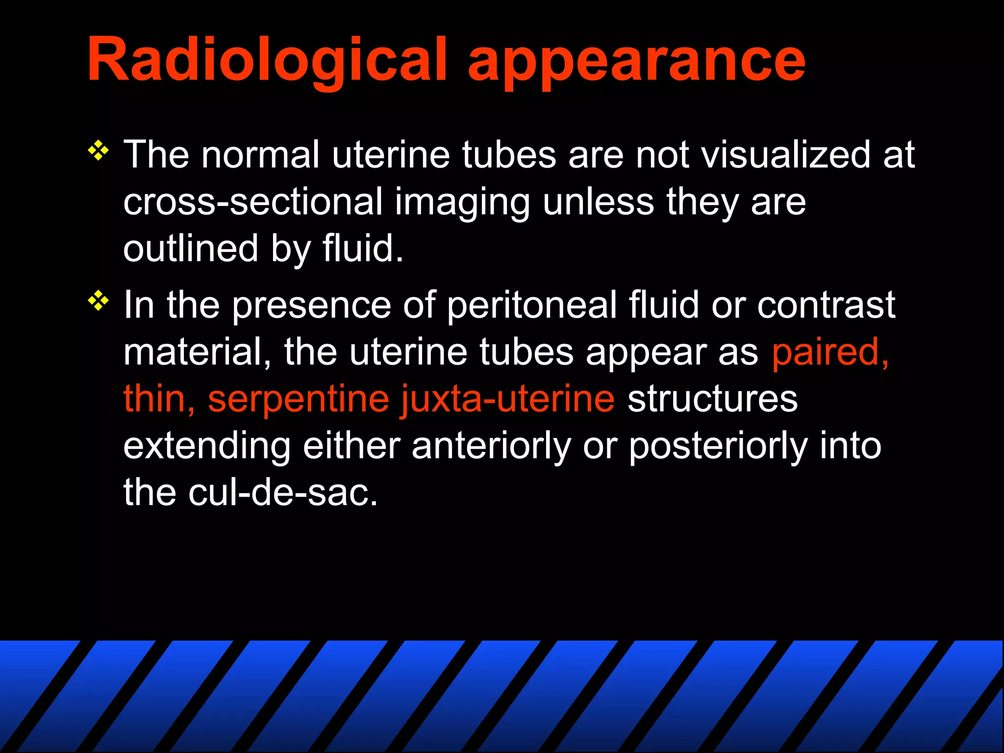 Fallopian tube radiology - Dr. Sumit Sharma | PPT