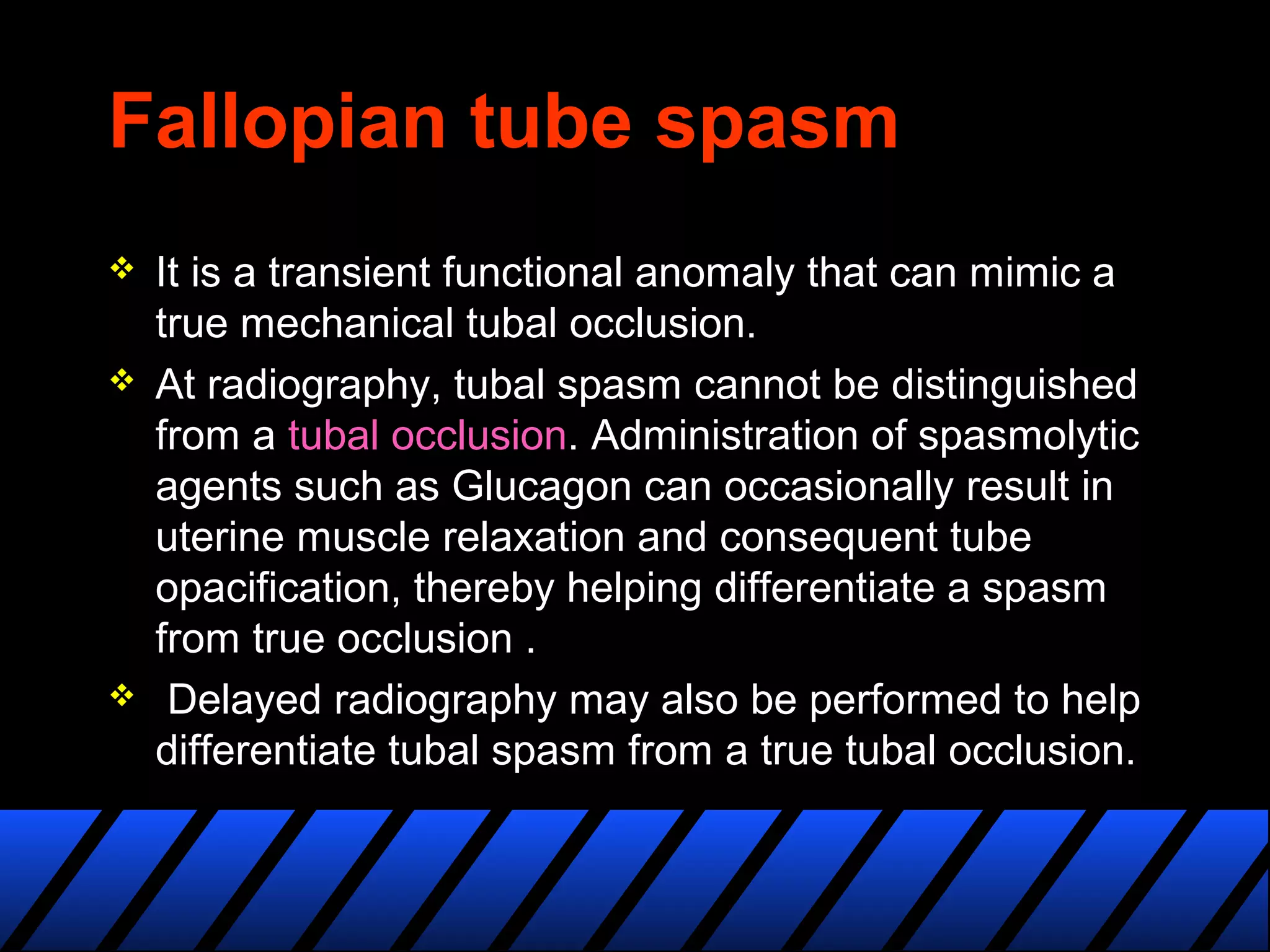 Fallopian tube radiology - Dr. Sumit Sharma | PPT