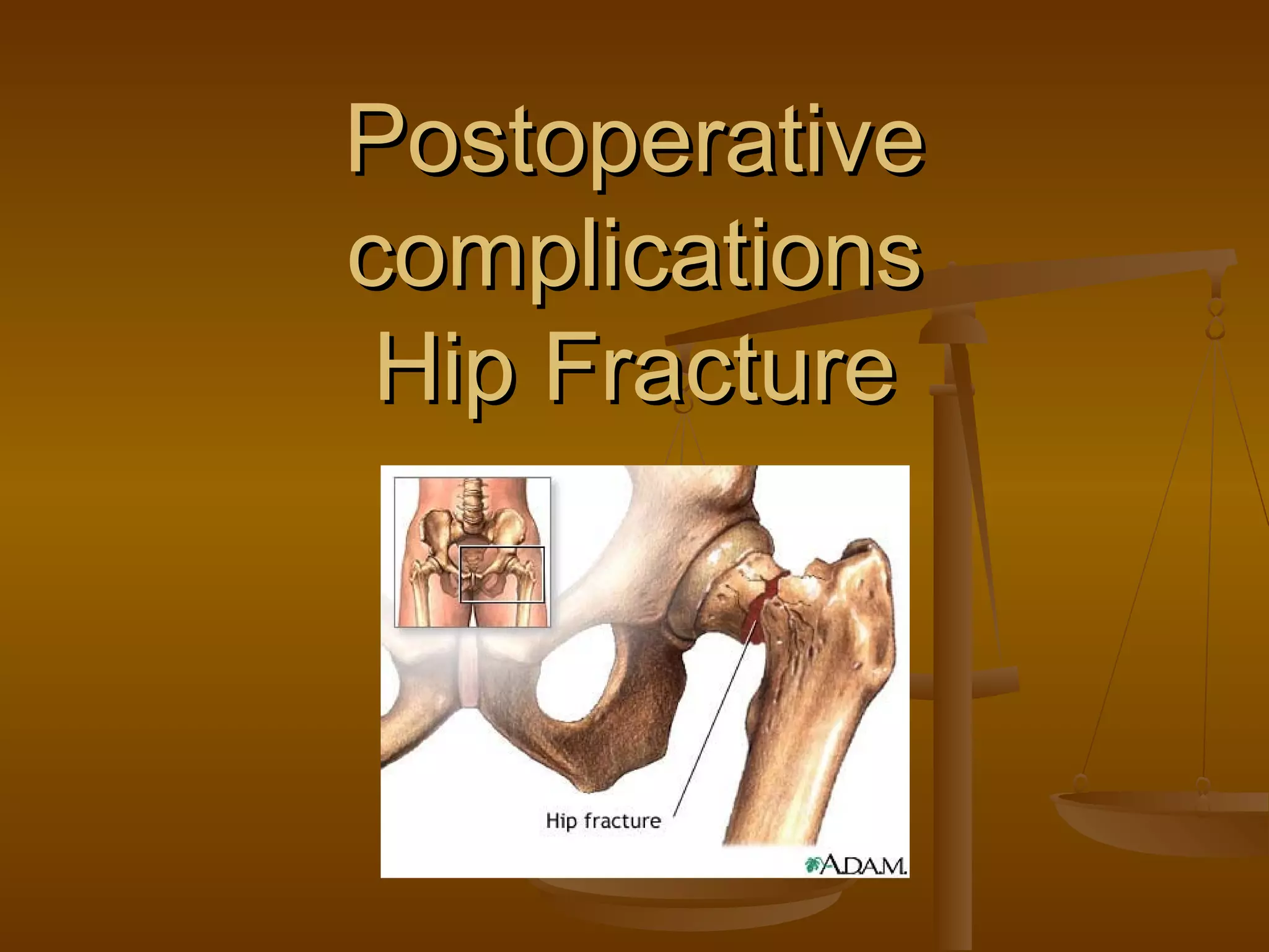 Complications of Falls | PPT