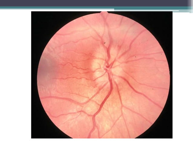 falselocalisingsigns.pdf