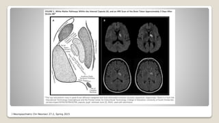 False Localising Signs In Neurology.pptx