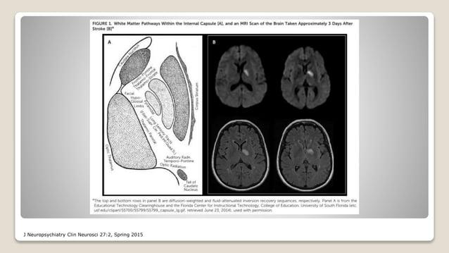 False Localising Signs In Neurology.pptx | Brain and Nervous System ...