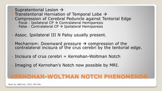 False Localising Signs In Neurology.pptx