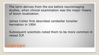 False Localising Signs In Neurology.pptx