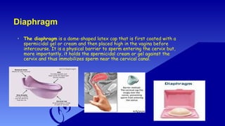 Famiily planning | PPT