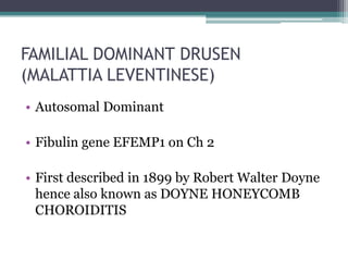 Familial dominant drusen | PPTX