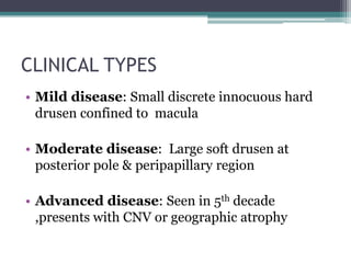 Familial dominant drusen | PPTX
