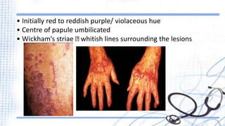 General practice (Family Medicine)- Amit kumar.pptx | Skin and ...