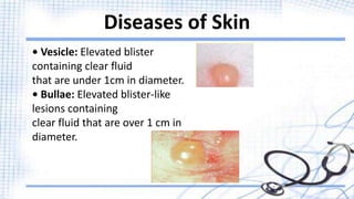 General practice (Family Medicine)- Amit kumar.pptx | Skin and ...