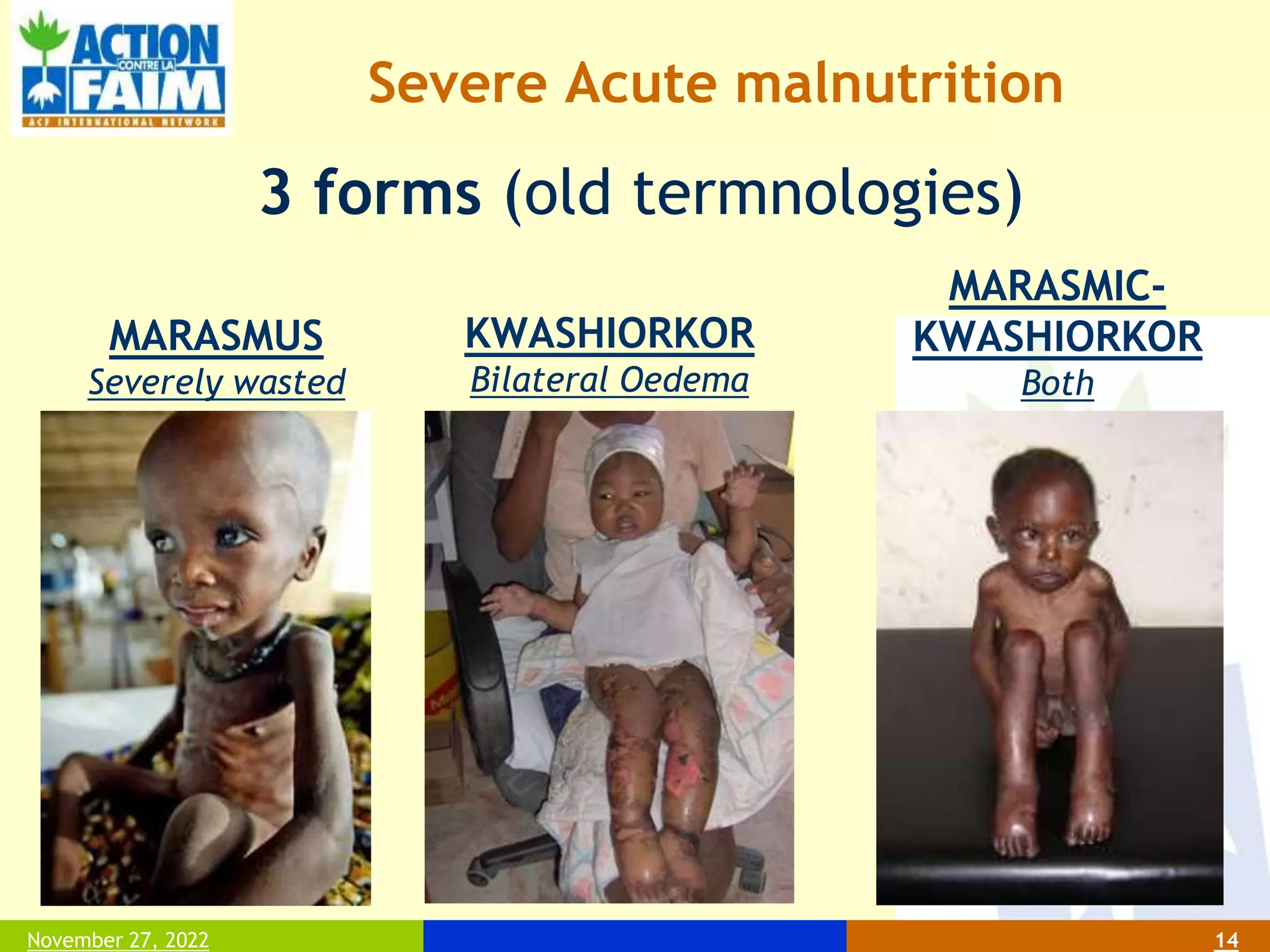 Family MUAC ppt edited (1).pptx