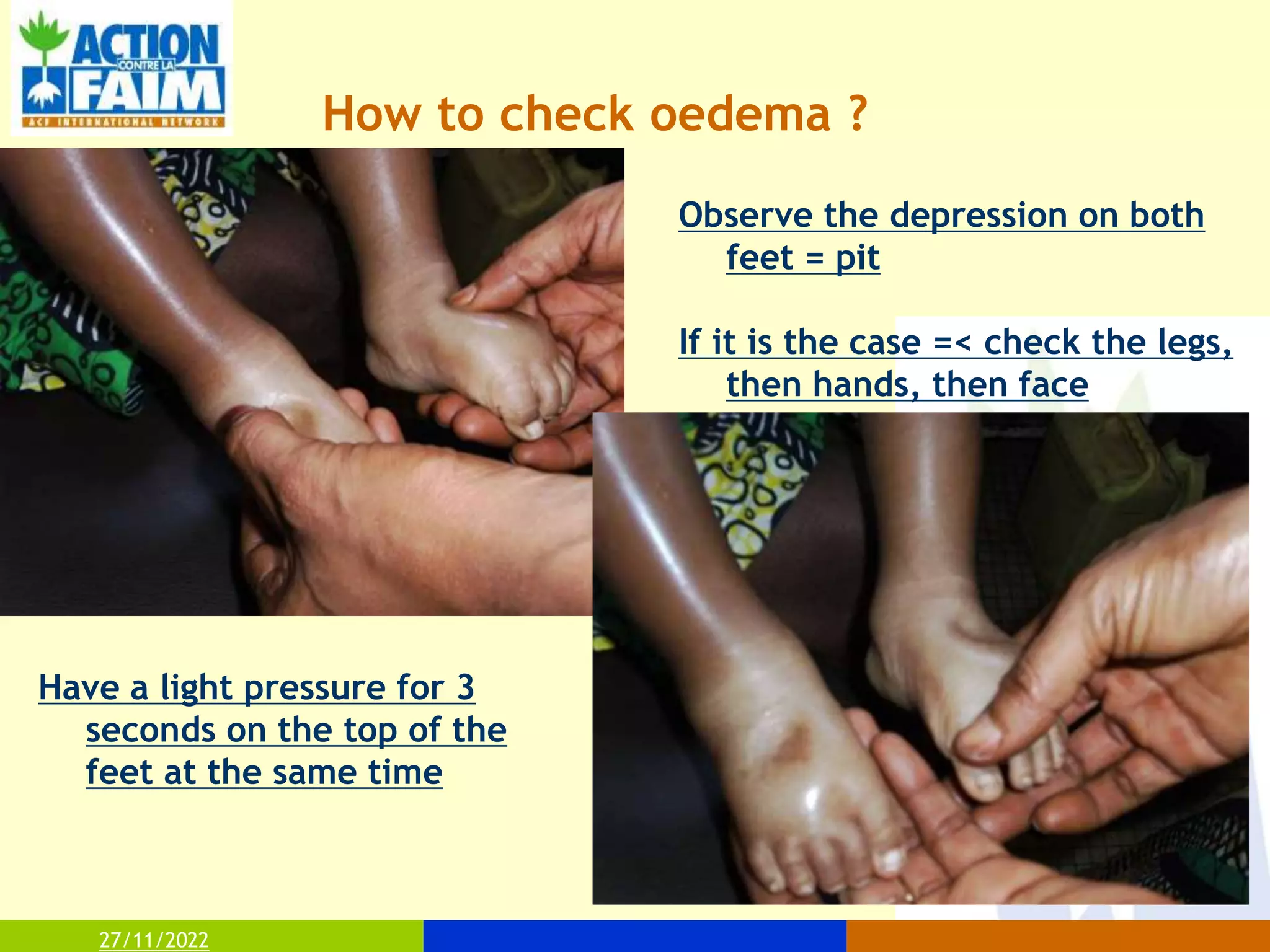 Family MUAC ppt edited (1).pptx