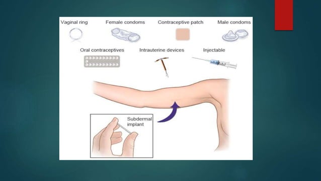 Family planning | PPTX | Pregnancy | Reproductive Health