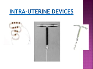 Family planning methods | PPTX