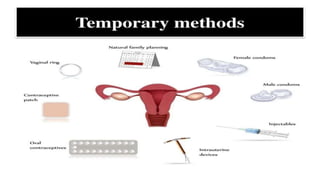 Family Planning (Contraceptive) Methods.pptx