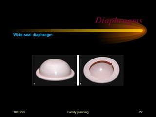Family planning Methods.ppt well explained ppt | PPT