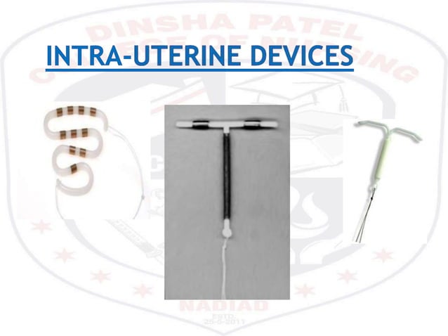 Family Planning Methods Ppt