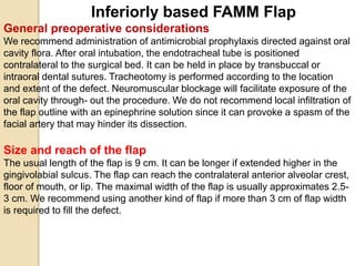Facial -Artery -musclo -mucosal -Flap presntion | PPTX