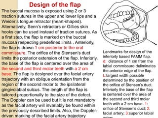Facial -Artery -musclo -mucosal -Flap presntion | PPTX
