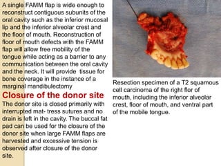 Facial -Artery -musclo -mucosal -Flap presntion | PPTX