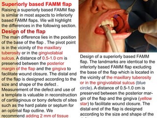 Facial -Artery -musclo -mucosal -Flap presntion | PPTX