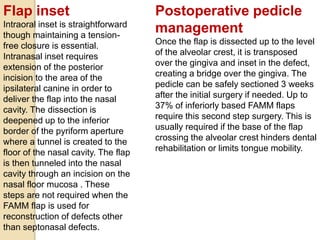 Facial -Artery -musclo -mucosal -Flap presntion | PPTX