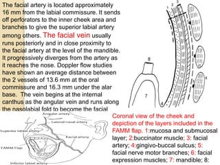 Facial -Artery -musclo -mucosal -Flap presntion | PPTX