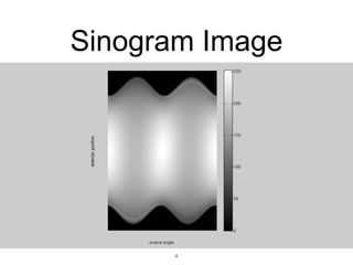 Fan Beam Reconstruction for Limited Views & Sparse Data | PPT